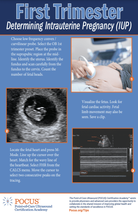 First Trimester Determining Intrauterine Pregnancy Iup