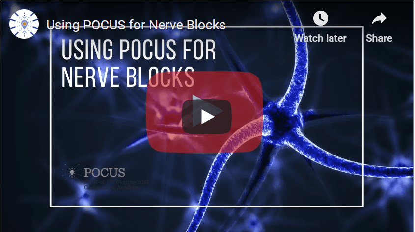 Using POCUS for Nerve Blocks | POCUS Resources & Case Studies | POCUS.org