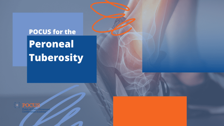POCUS For The Peroneal Tuberosity POCUS Resources Case Studies POCUS pocus-for-the-peroneal-tuberosity-pocus-resources-case-studies-pocus