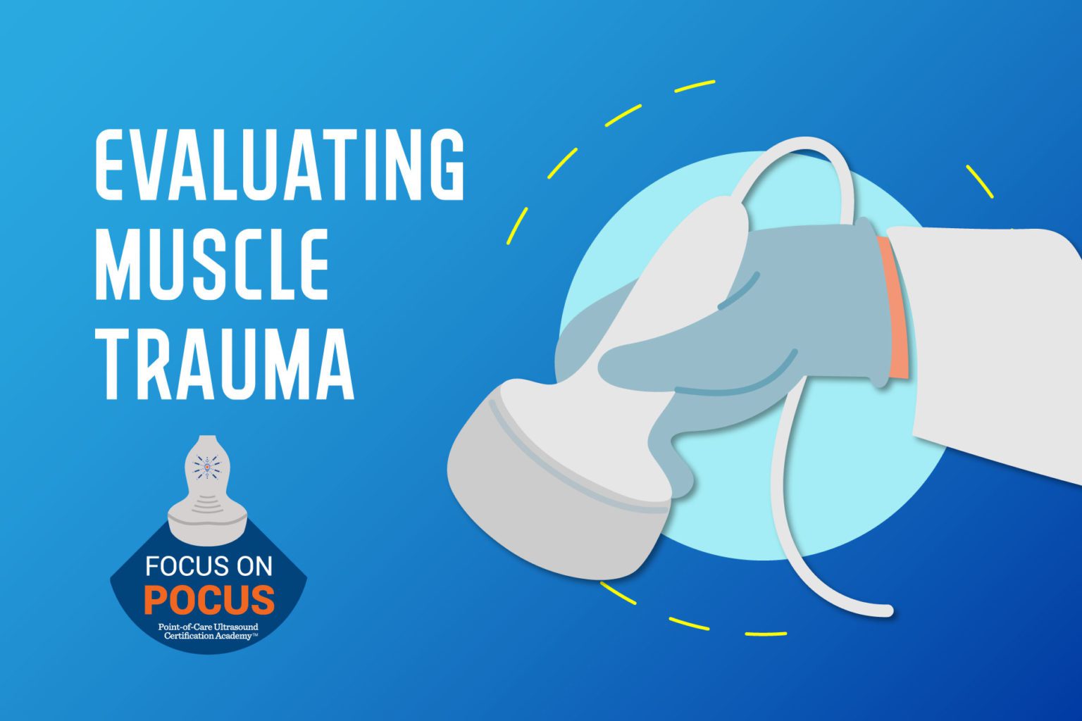 Evaluating Muscle Trauma: POCUS as First Line Imaging