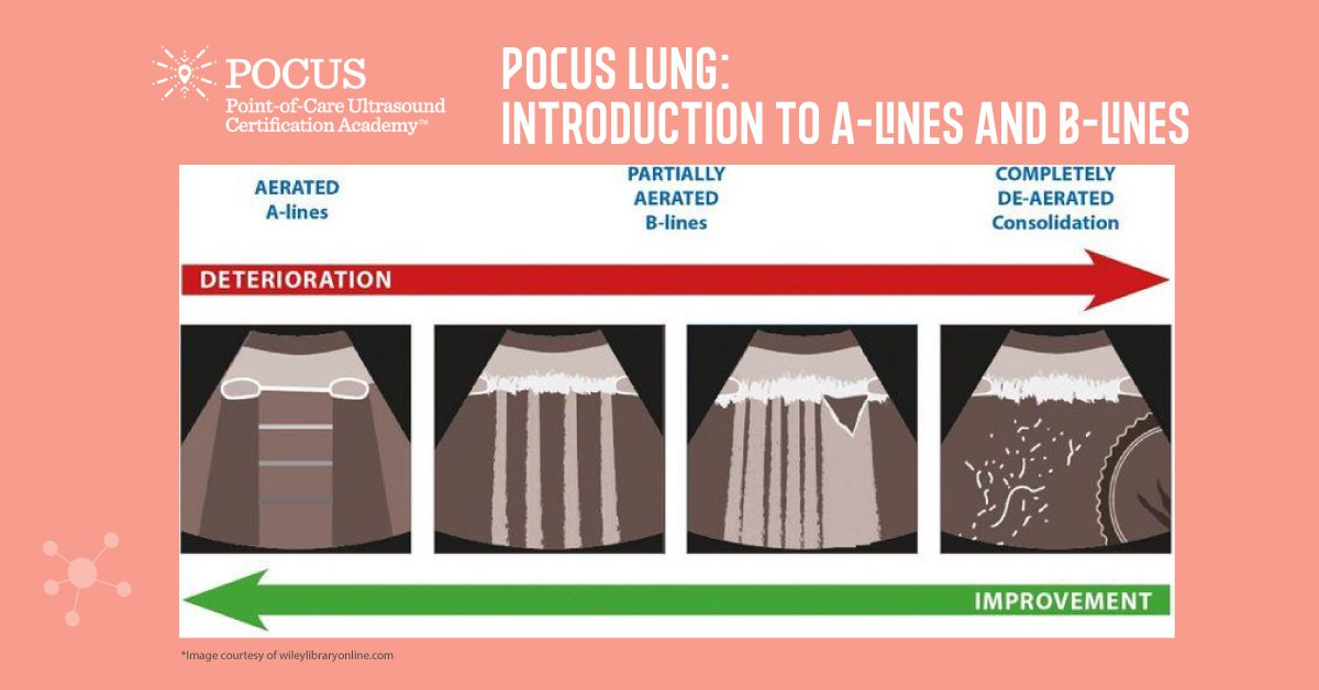Pocus Lung Introduction To A Lines And B Lines Point Of Care Ultrasound Certification Academy