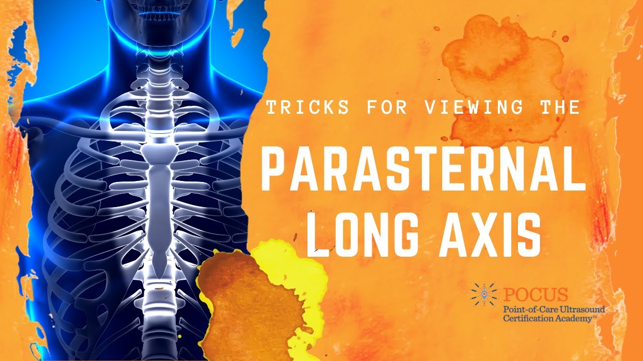 Tricks for Viewing the Parasternal Long Axis | POCUS Resources & Case ...